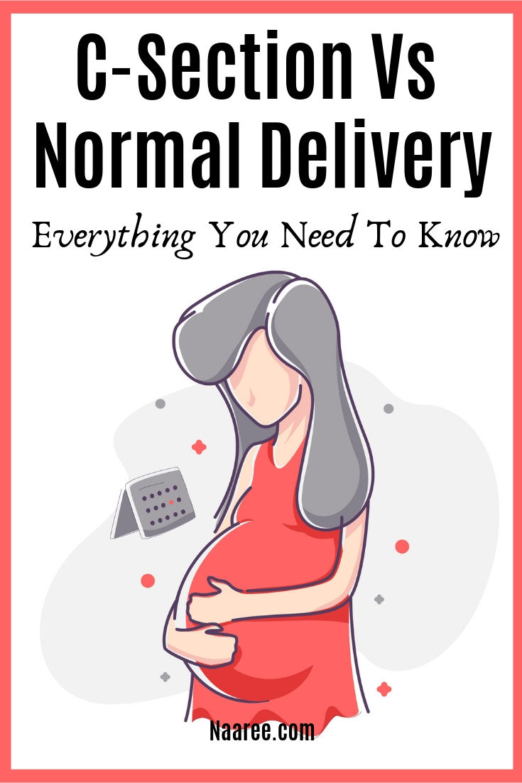 C-Section Vs Natural Birth: Everything You Need To Know